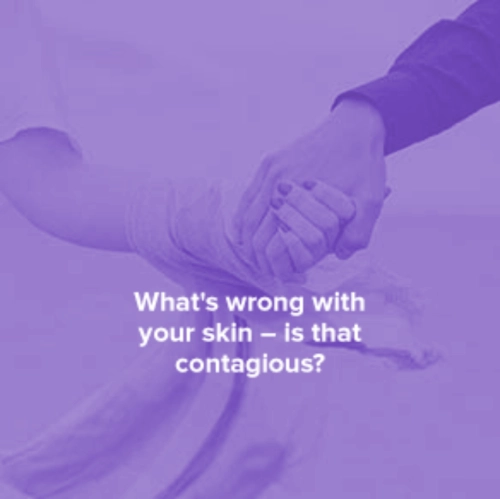 The Impact of Atopic Dermatitis